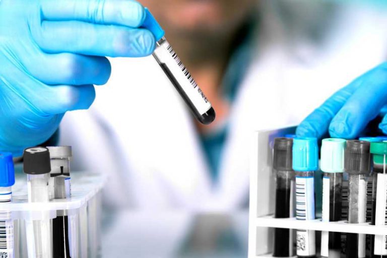 Polytech LIS Features