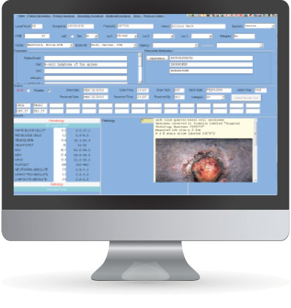 The Best LIS On The Market